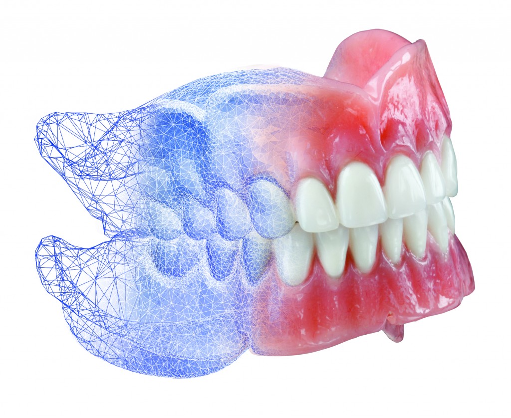 Digitale gebitsprothese | TPP Dokman Sleeuwijk